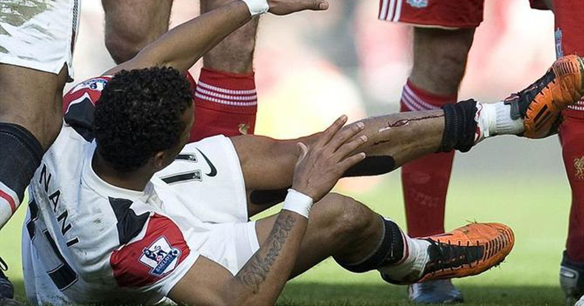 «Sir Alex disse ao Nani: “Espero que tenhas a perna partida!”» | A Bola