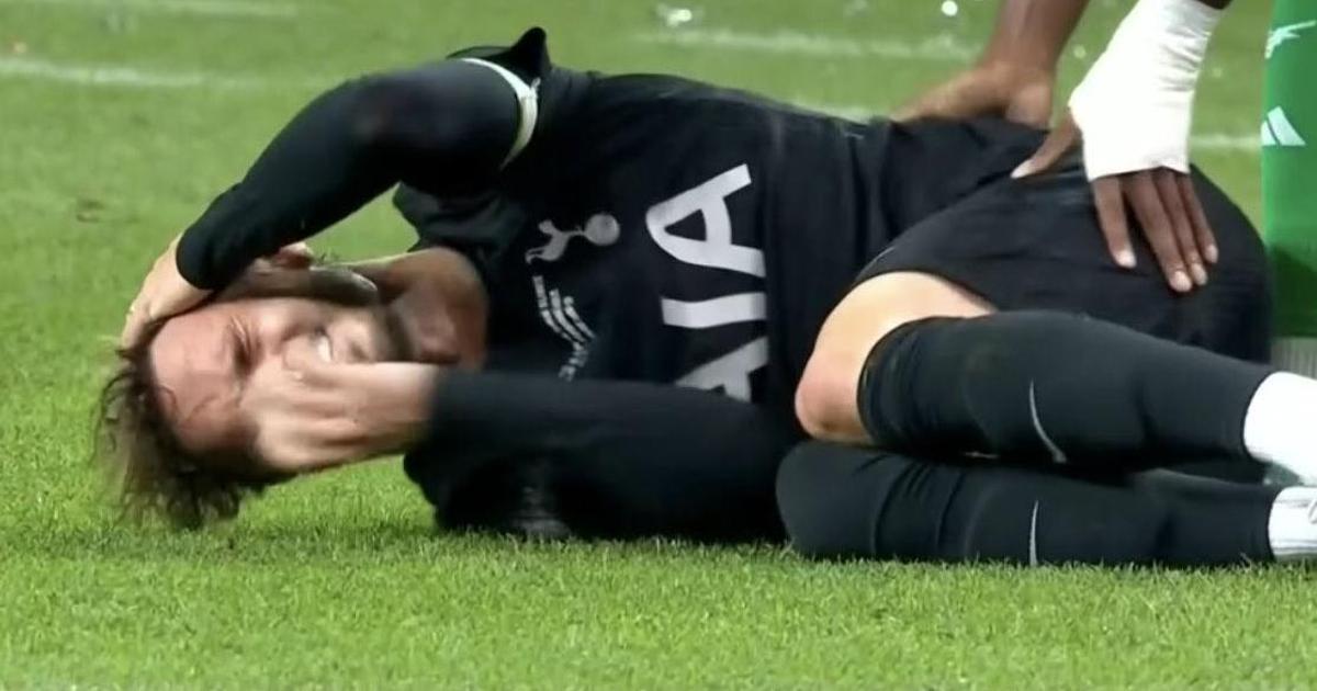 James Maddison rompe o ligamento cruzado anterior | A Bola