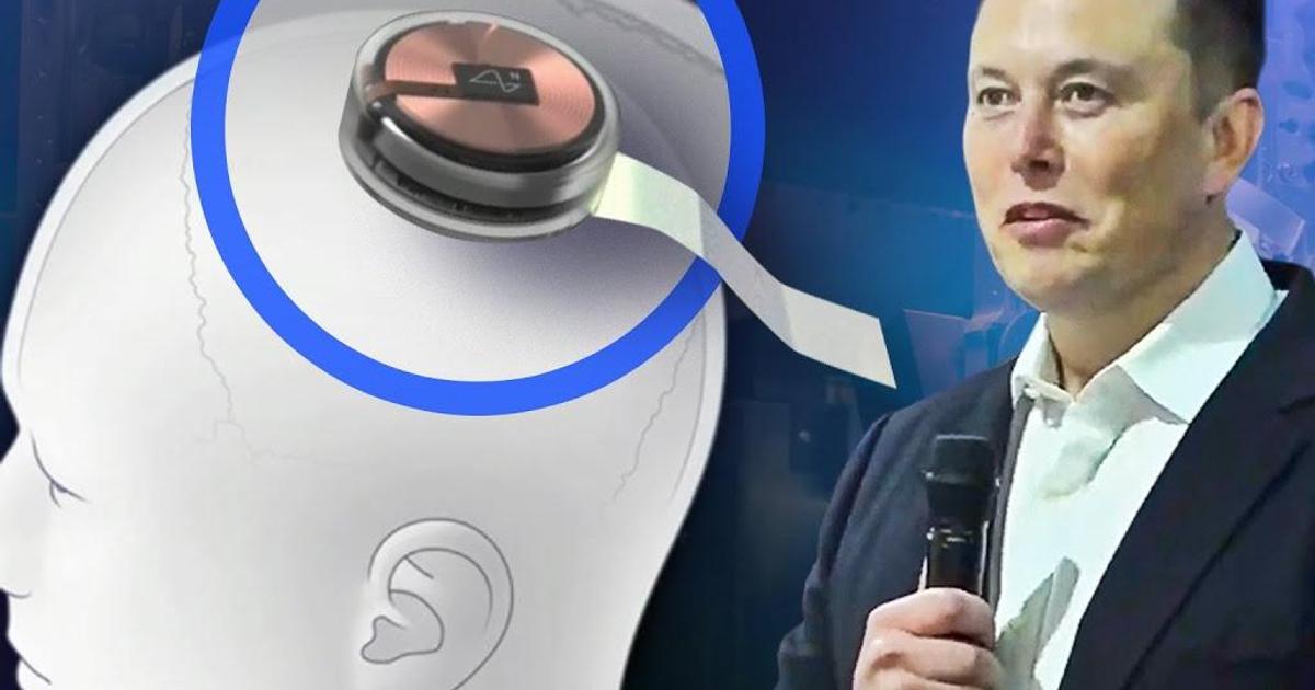 How Elon Musk's Brain Chip Works: Inside Neuralink's Revolutionary ...