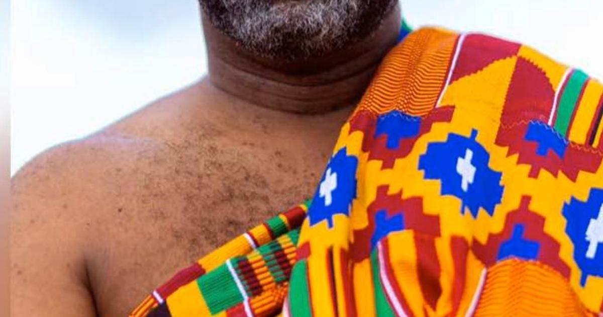 We will be back stronger – NAPO breaks silence on NPP’s massive defeat ...