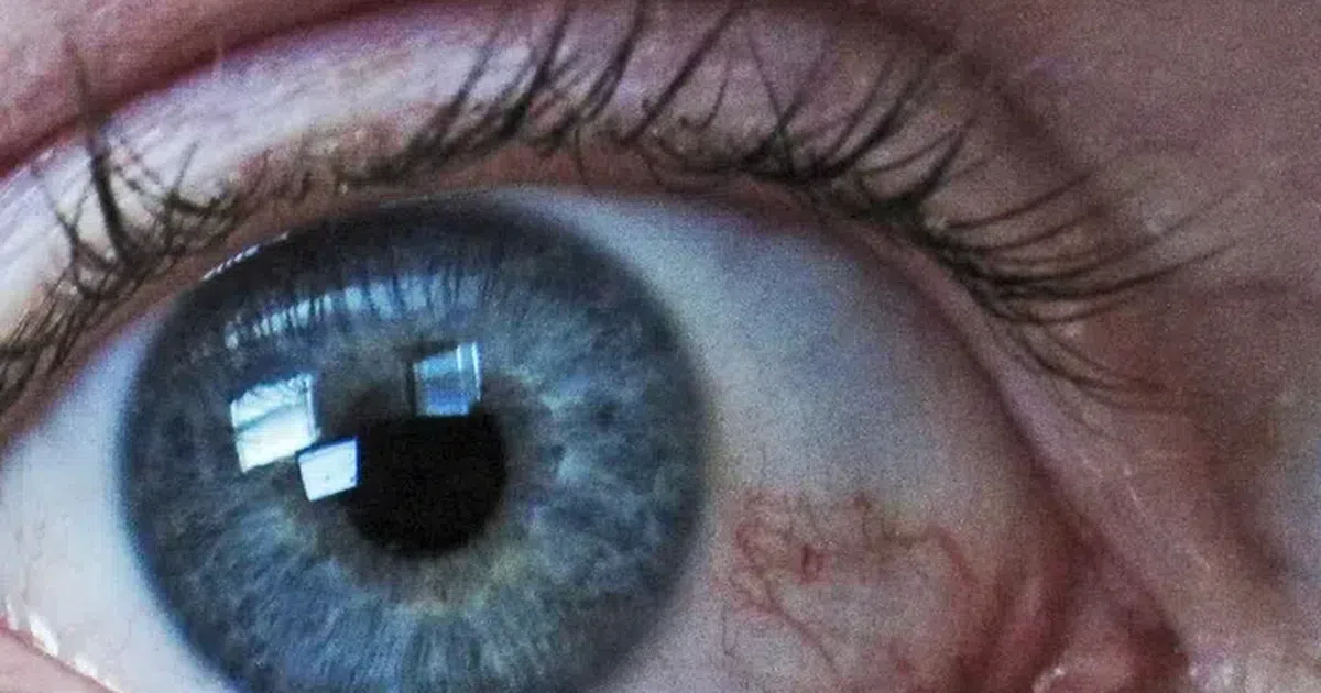 The silent thief of sight: How glaucoma steals vision without warning ...