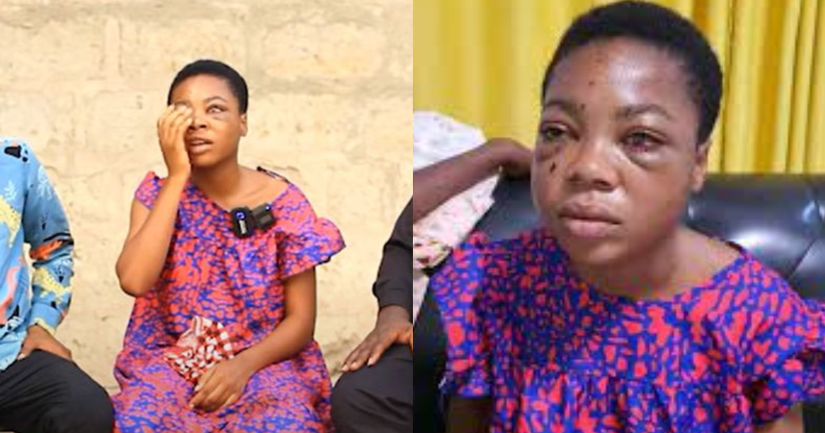 Female SHS student shot in the eye in school receives support from ...
