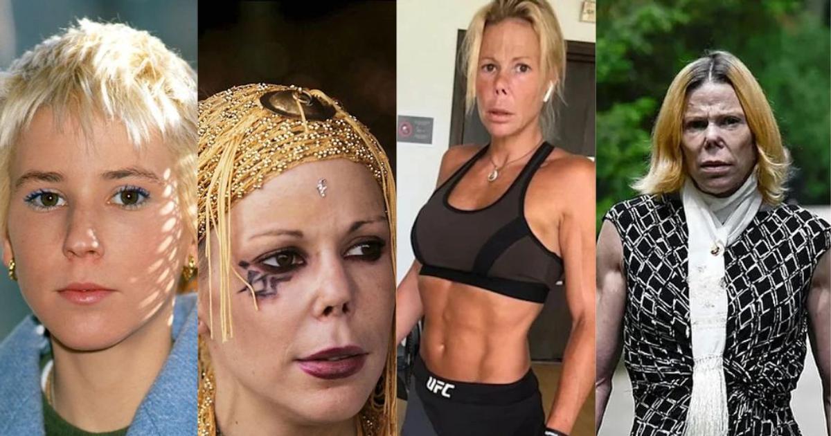 How a childhood accident led to a shocking physical transformation for ...