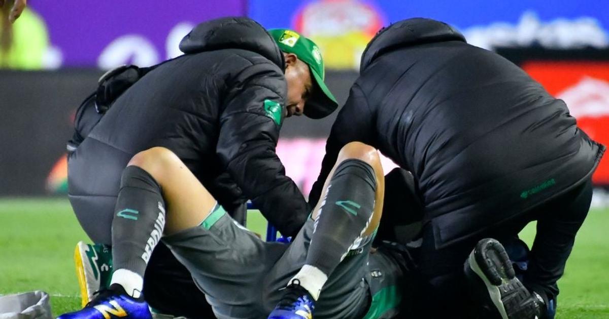 Elías Montiel hace entrada criminal a James Rodríguez, casi lo rompe y ...