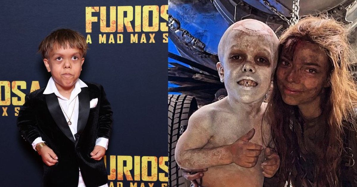 Quaden Bayles, de víctima de bullying a trabajar con Anya Taylor-Joy en ...