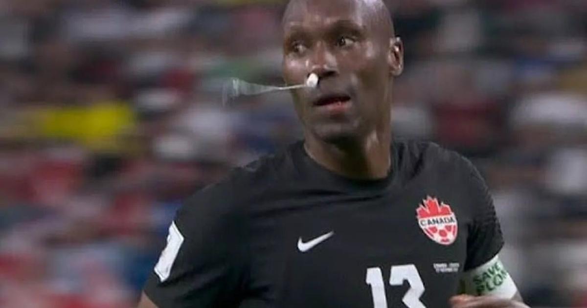 Qatar 2022: Atiba Hutchinson detuvo su hemorragia nasal con tampón | RÉCORD