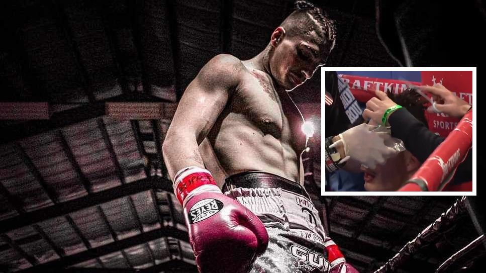 Bizar: bokser gaat midden in een gevecht naar de kapper en lijkt ...